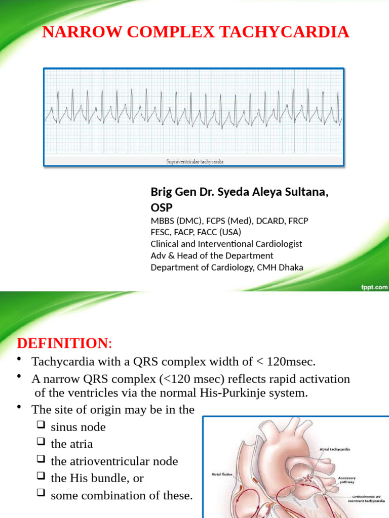 Understanding Narrow Complex Tachycardia | PDF | Electrocardiography ...