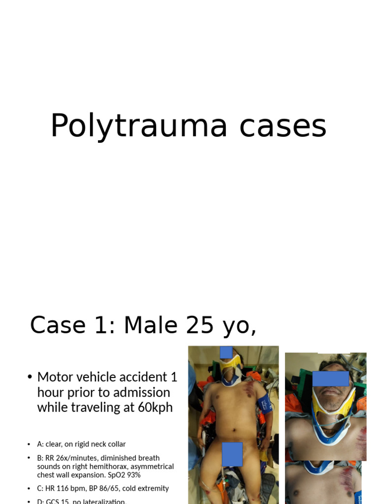 Polytrauma Case Management Overview | PDF | Thorax | Medical Specialties