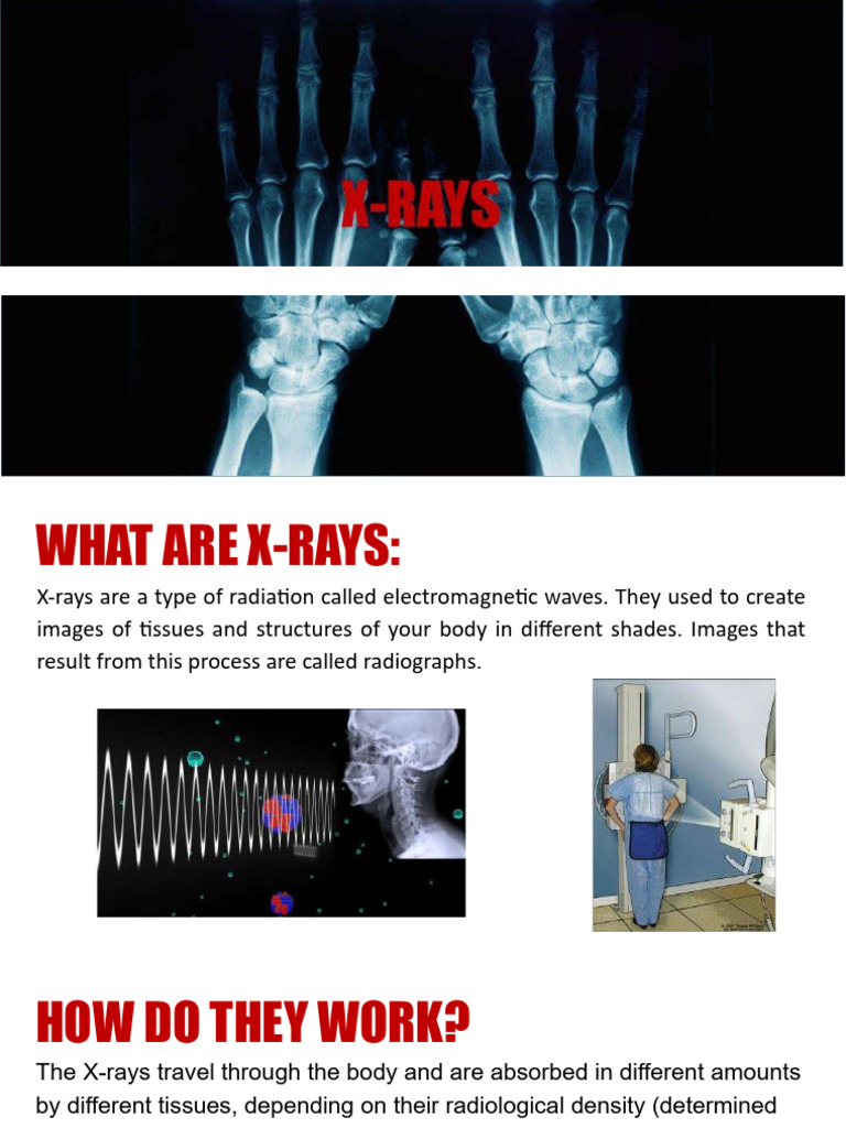 Rayos X | PDF