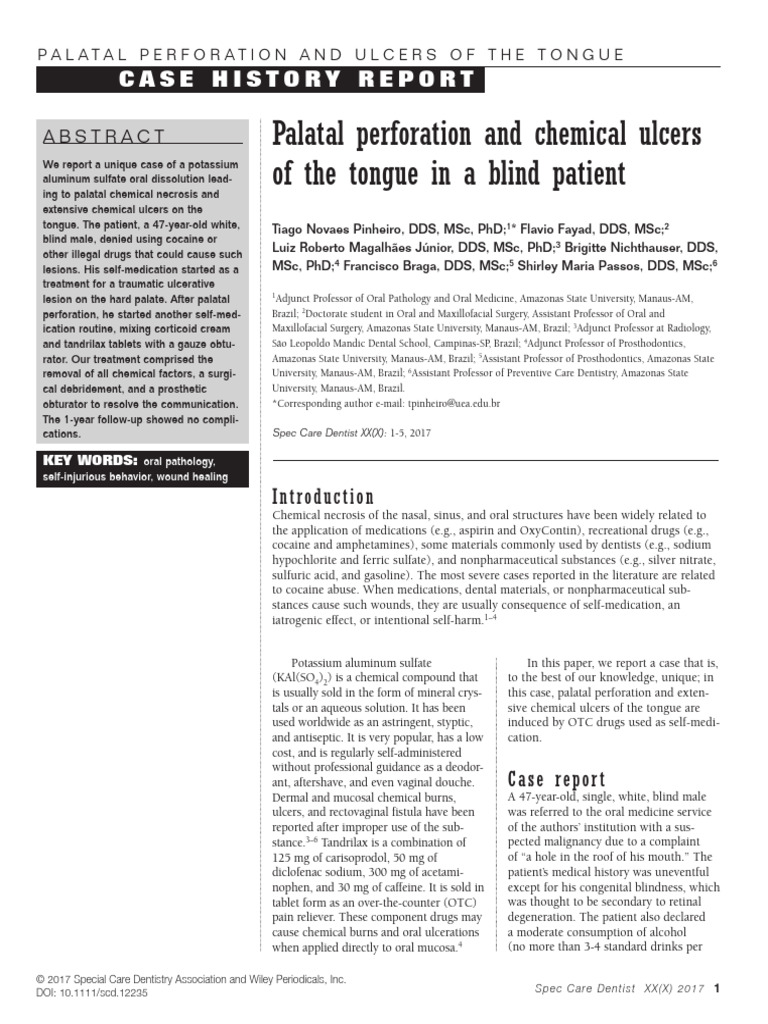 Palatal Perforation and Chemical Ulcers of The Tongue in A Blind ...