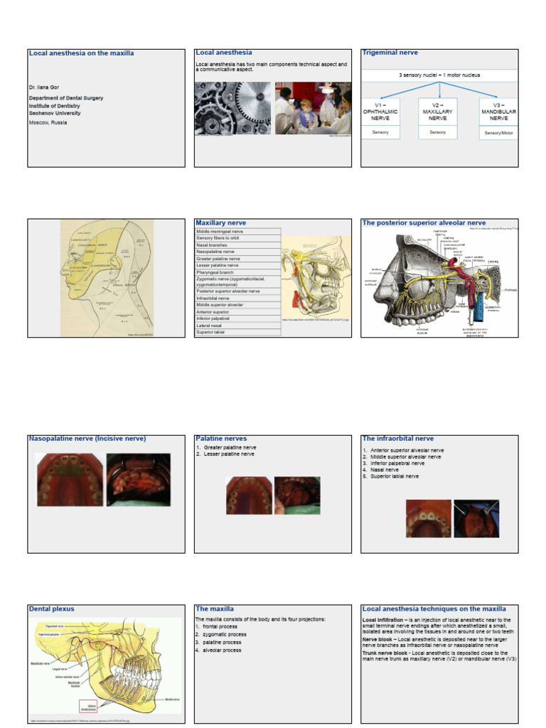 Maxillary Local Anesthesia Techniques | PDF | Anesthesia | Injection ...