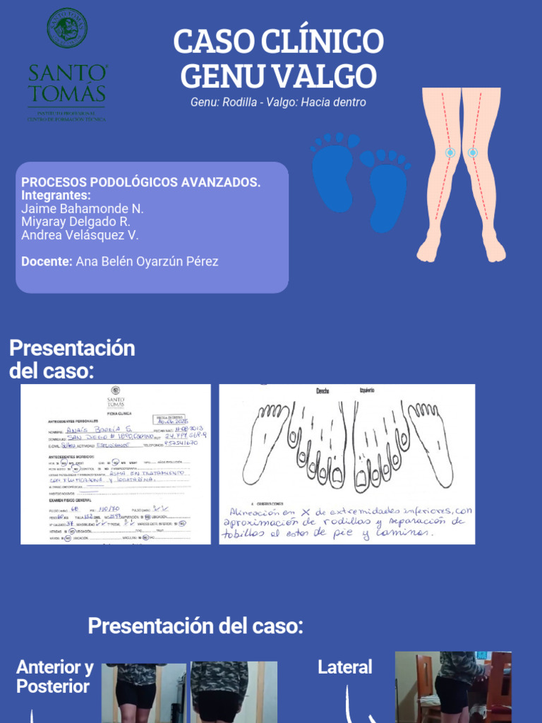 Genu Valgo: Diagnóstico y Tratamiento | PDF | Rodilla | Pie