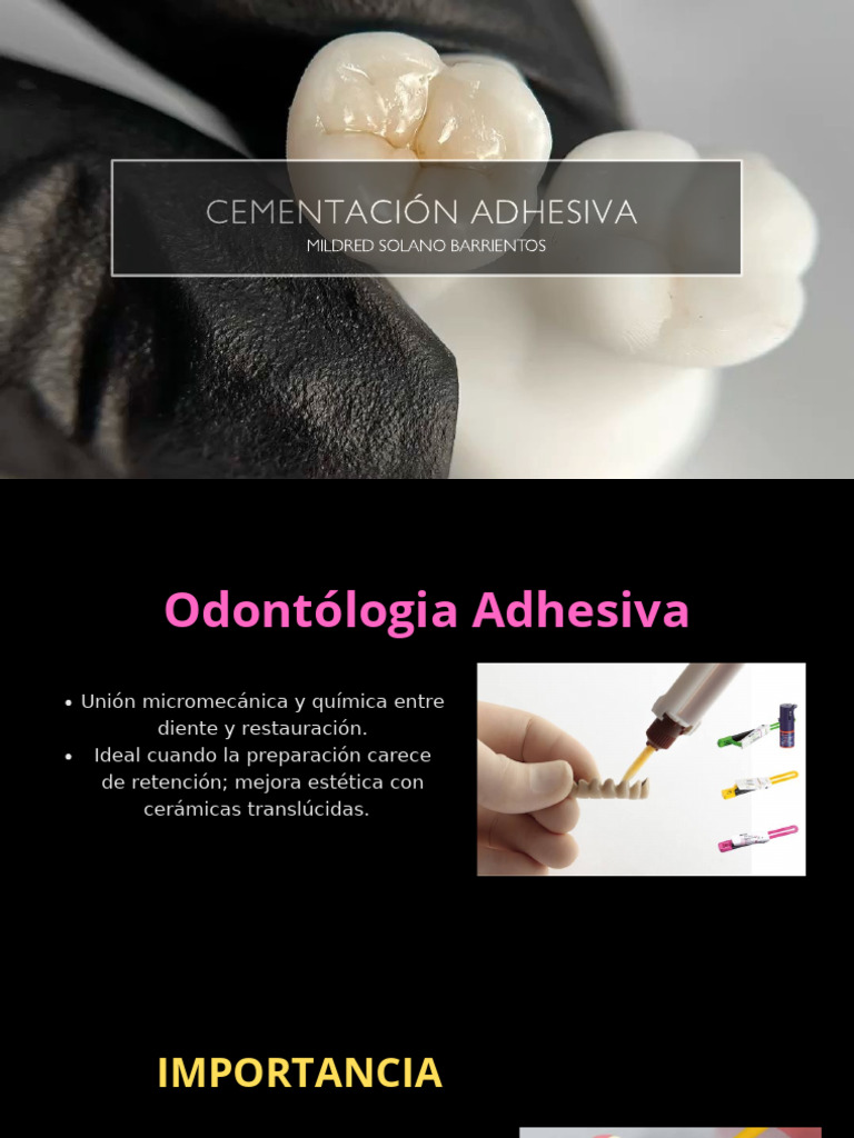 Cementación Adhesiva Mildred Solano PDF | PDF