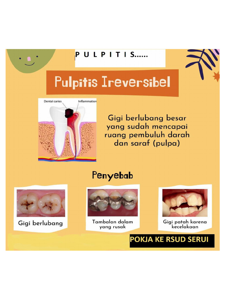 Ke..d.3 Pulpitis | PDF