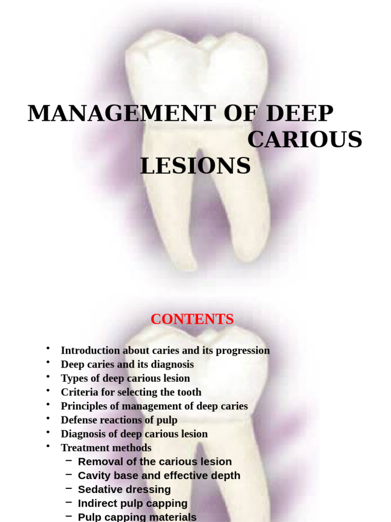 Deep Caries Management Techniques | PDF | Dentin | Mouth