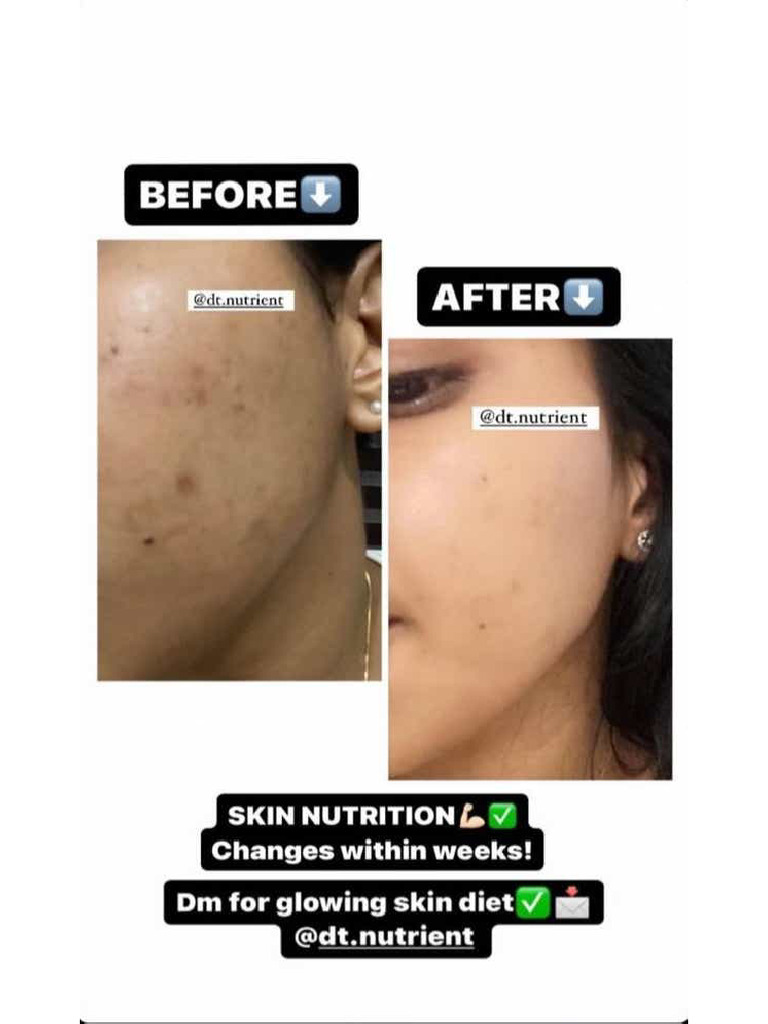 Skin glow transformation | PDF