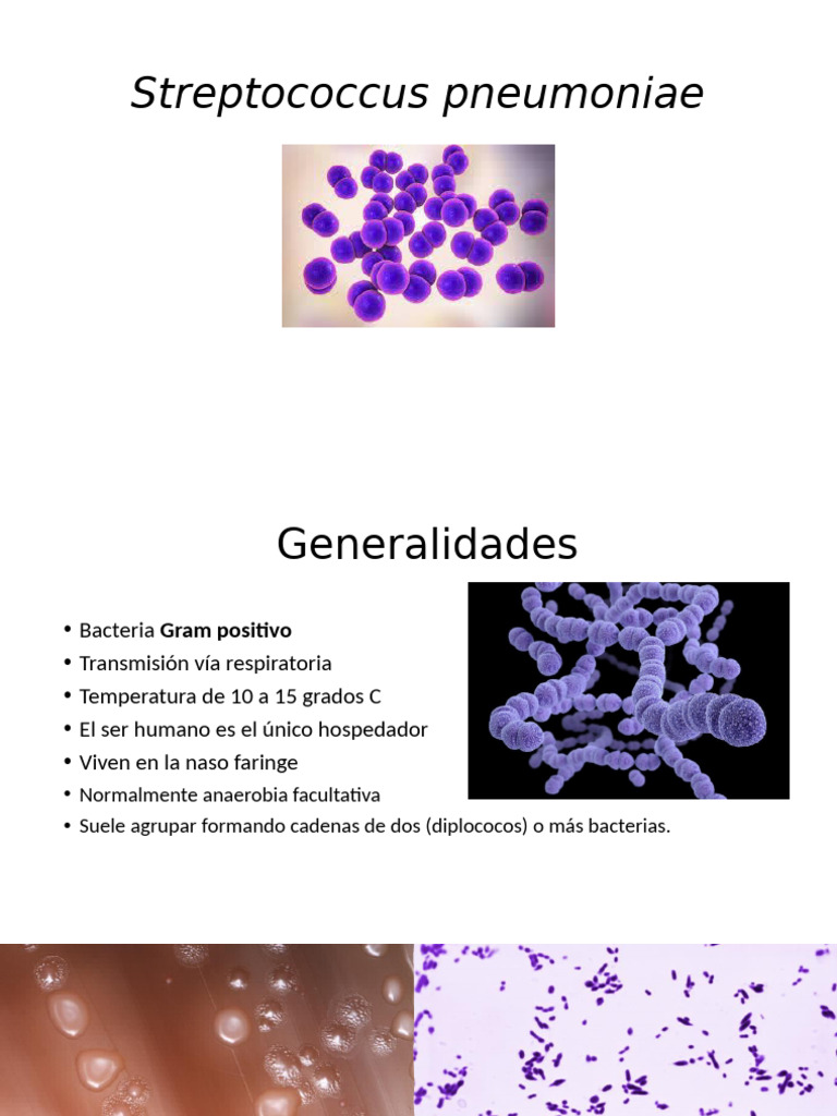 Streptococcus Pneumoniae Bacter 11 | PDF