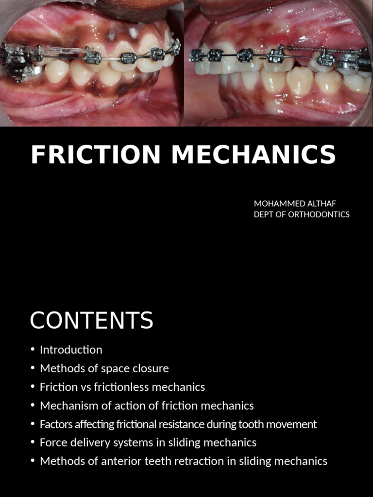Friction Mechanics | PDF | Orthodontics | Friction