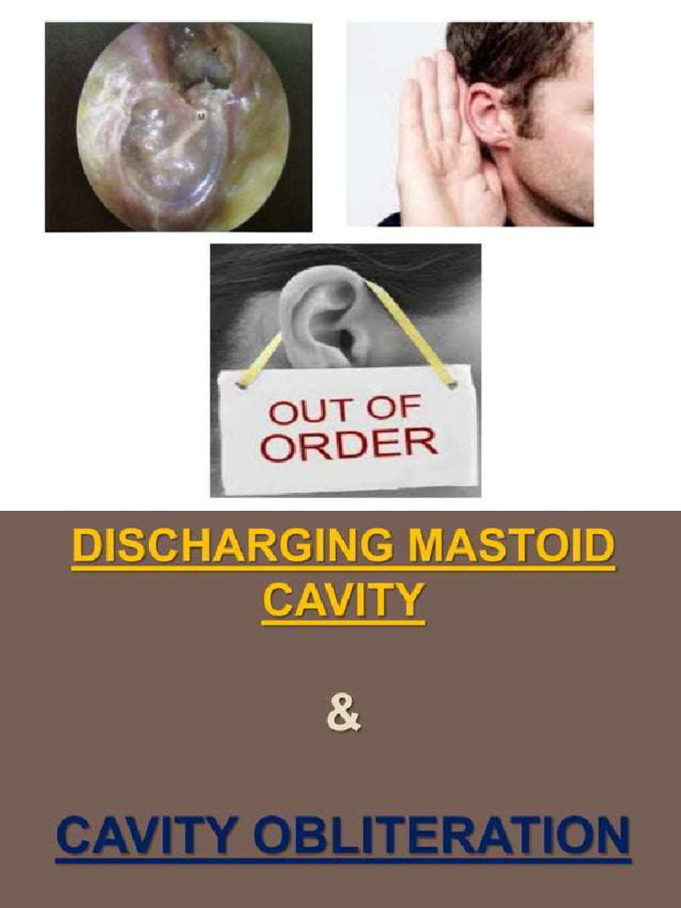 Mastoid Obliteration | PDF