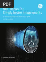 MAGNETOM Flow.Plus: Next-Gen 1.5T MRI | PDF | Magnetic Resonance ...