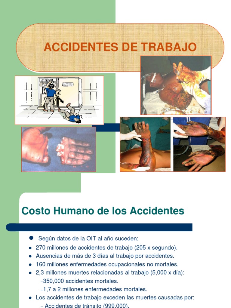 tipos de accidentes | Derecho laboral | Accidente (general)