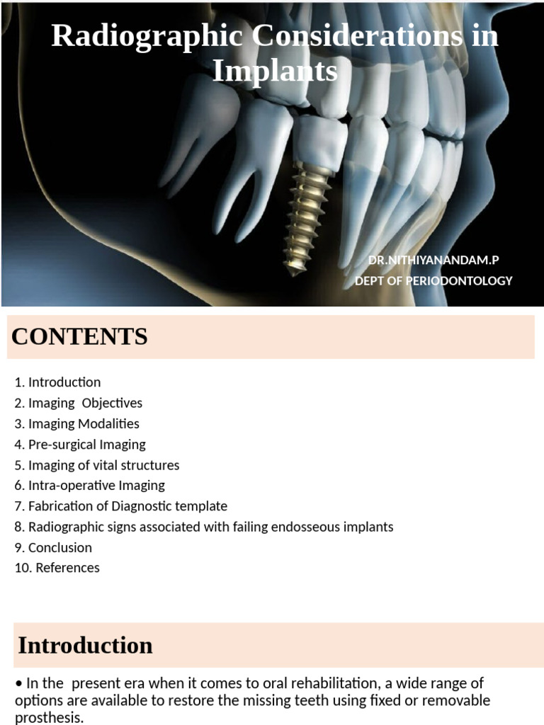 9.radiographic Considerations in Implants | PDF | Dental Implant ...