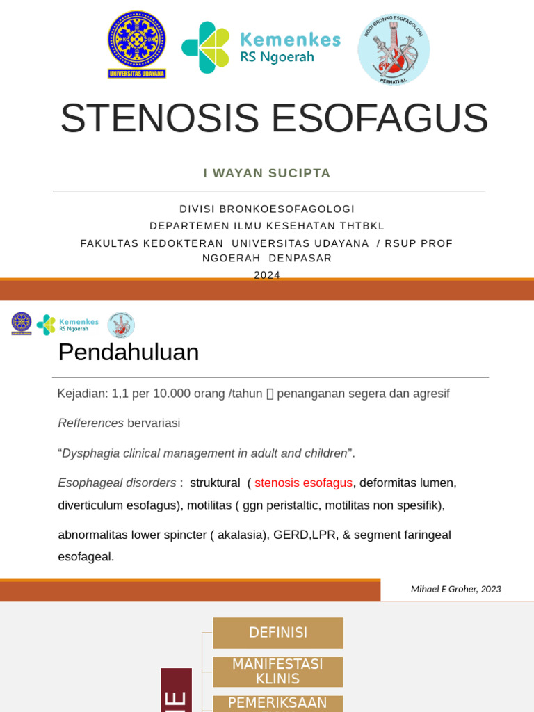 Stenosis dan Striktur Esofagus | PDF
