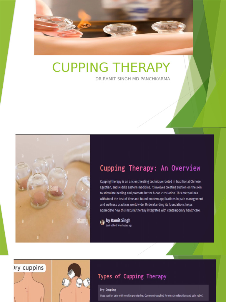 Cupping Therapy | PDF