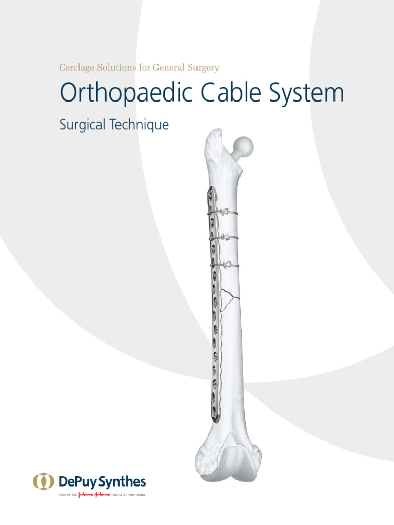 Synthes Orthopaedic Cable System | PDF