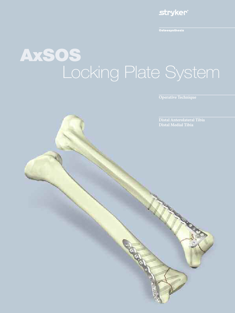 AxSOS Distal Tibia | PDF | Screw | Drill