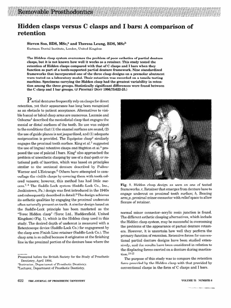 Hidden Clasp Vs C Clasp and I Bar | PDF | Dentures | Dentistry Branches