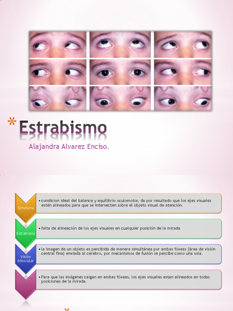 Estrabismo | PDF | Oftalmología | Medicina