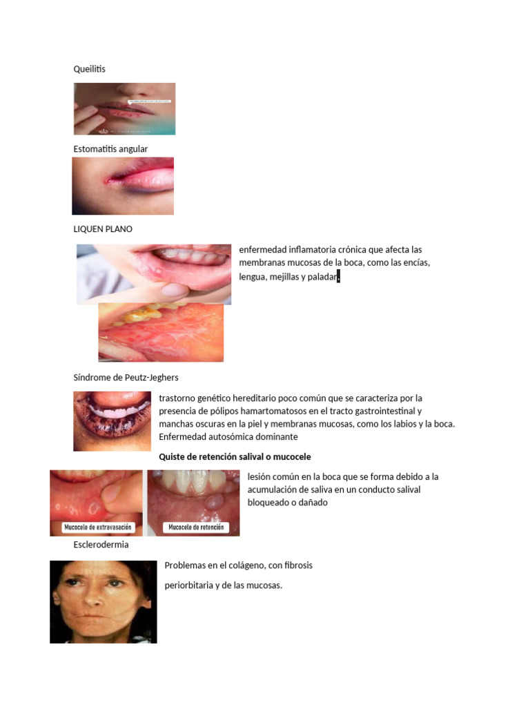 Enfermedades y condiciones orales y oculares | PDF | Ojo humano | Glaucoma