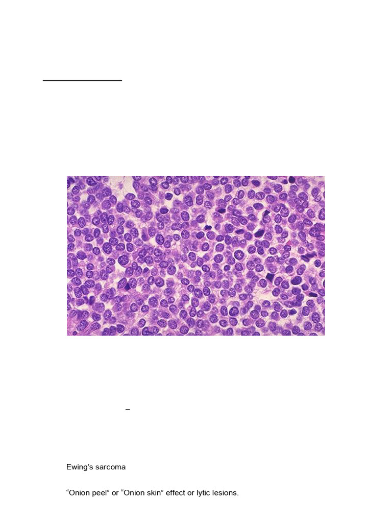 Tophus Pathology in Bone Lesions | PDF | Gout | Diseases And Disorders