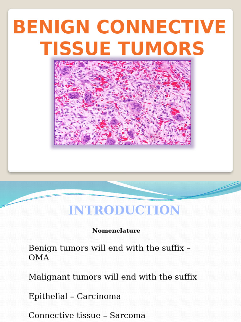 Benign Connective Tissue Tumors-1 | PDF | Diseases And Disorders | Anatomy