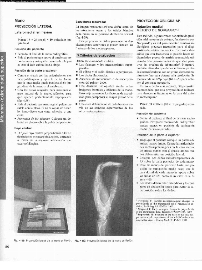 BALLINGER MIEMBRO SUPERIOR II | PDF