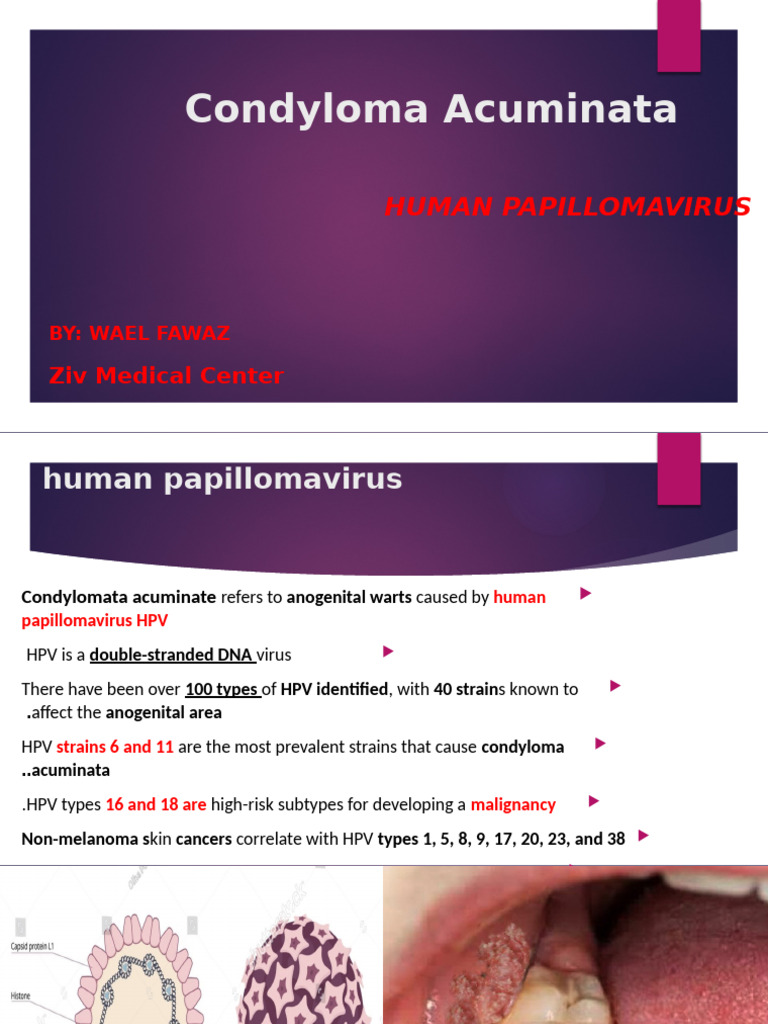 Condyloma Acuminata 5 | PDF | Virus | Epidermis