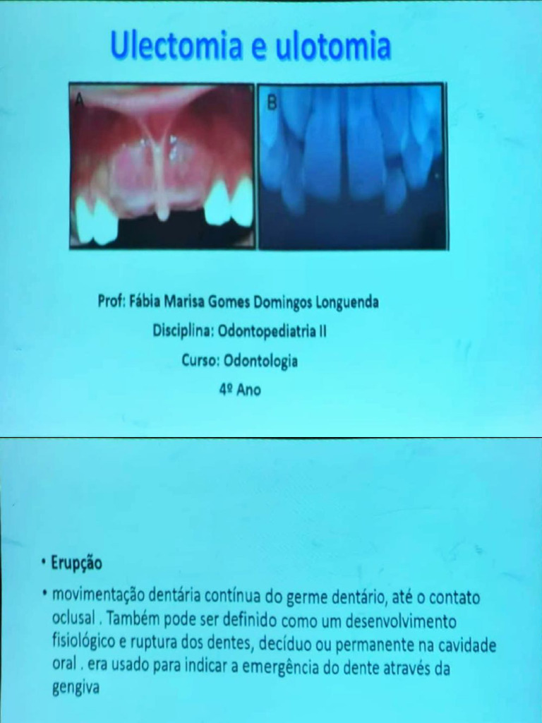 Ulectomia e Ulotomia. | PDF