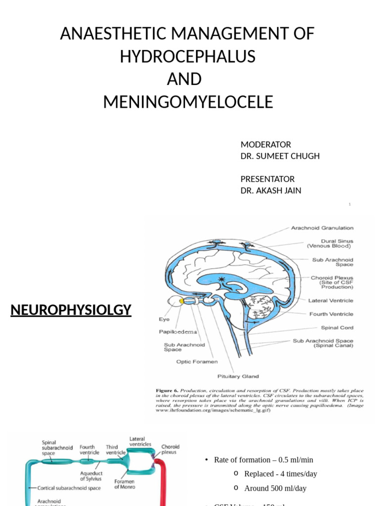 Anesthetic Management of Hydrocephalus | PDF | Cerebrospinal Fluid ...