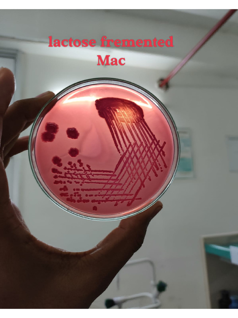 Micro Culture | PDF