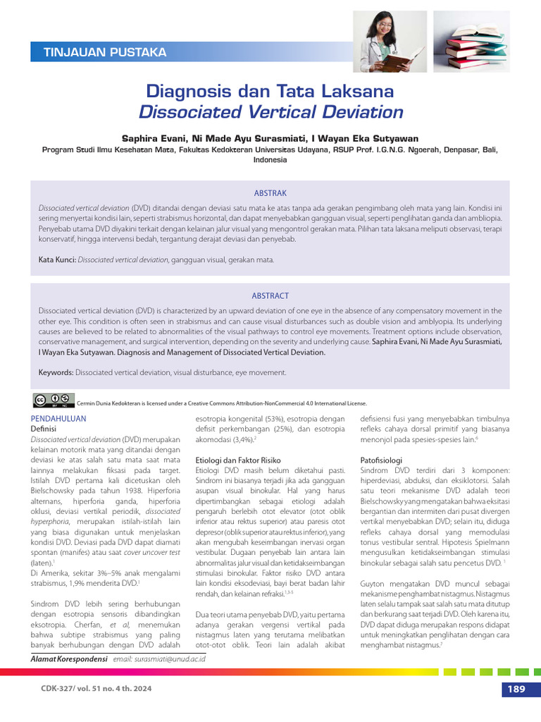 Manajemen Dissociated Vertical Deviation | PDF