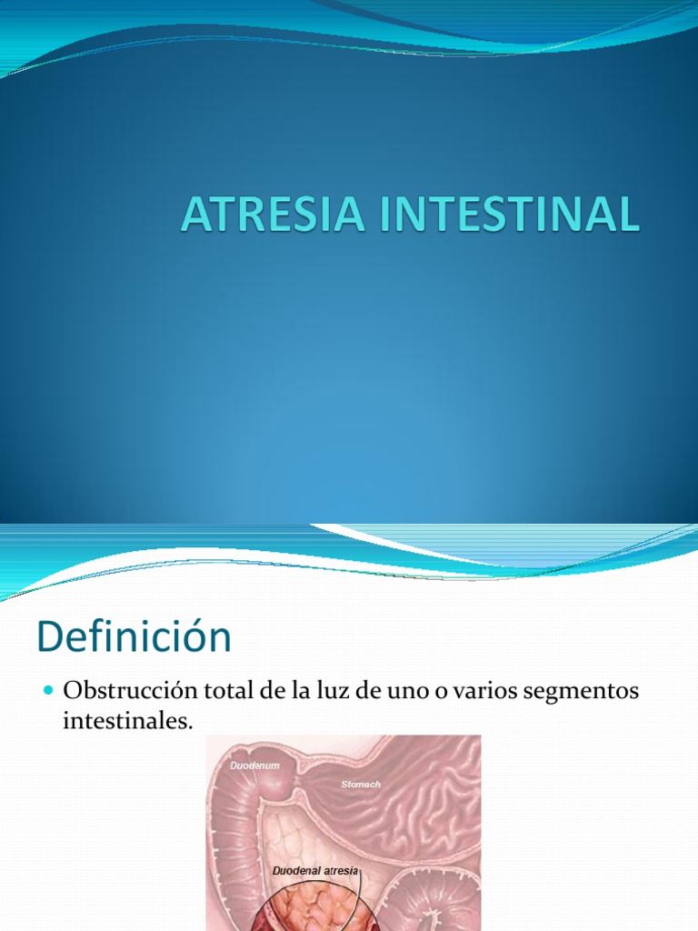 Atresia Intestinal | PDF