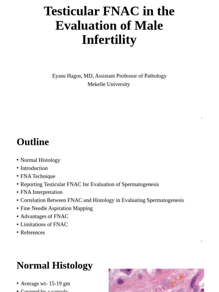 Testicular FNAC for Male Infertility Evaluation | PDF | Medical ...