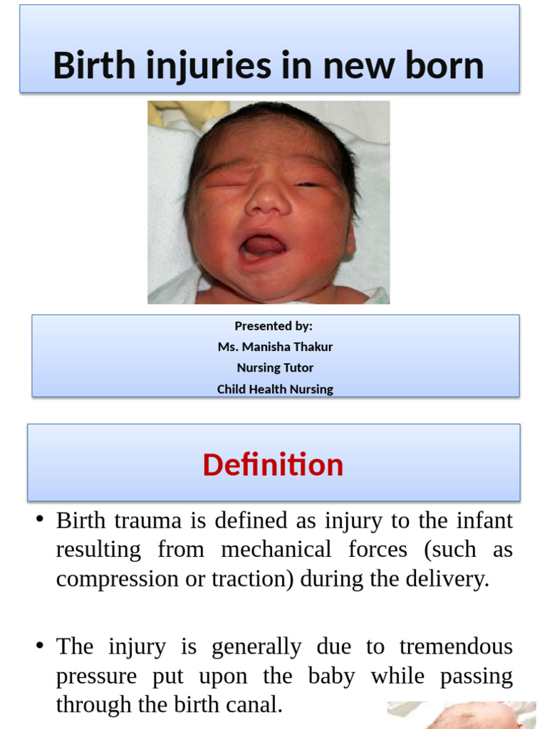 Understanding Birth Injuries in Newborns | PDF | Childbirth | Caesarean ...