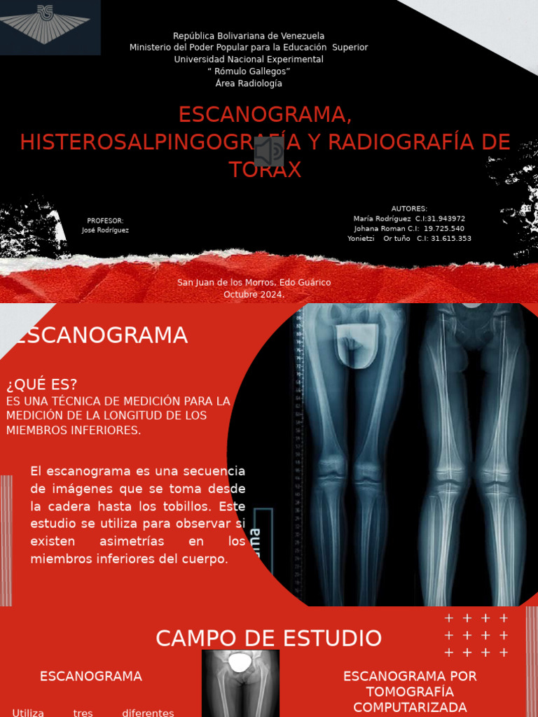 Estudios Radiologicos. | PDF | Tórax | Pulmón