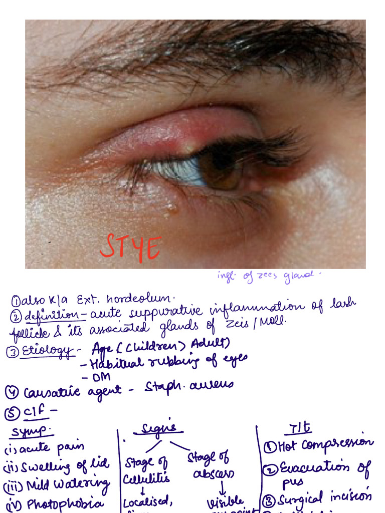 Optha Short Case | PDF