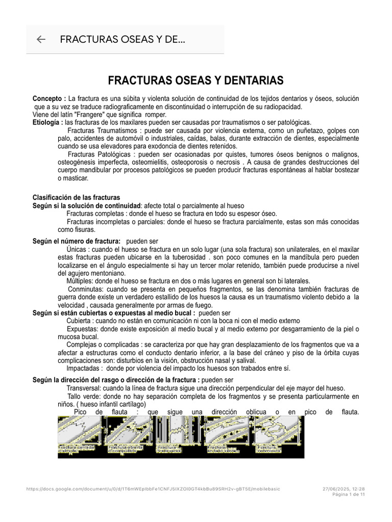 Fracturas Oseas Y Dentarias Pdf Anatomía Humana Cabeza Y Cuello