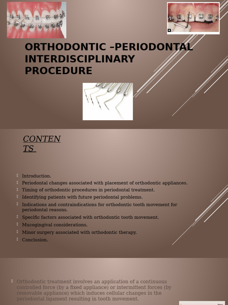 Ortho Perio Interdisciplinary Procedure | PDF | Periodontology | Dental Anatomy