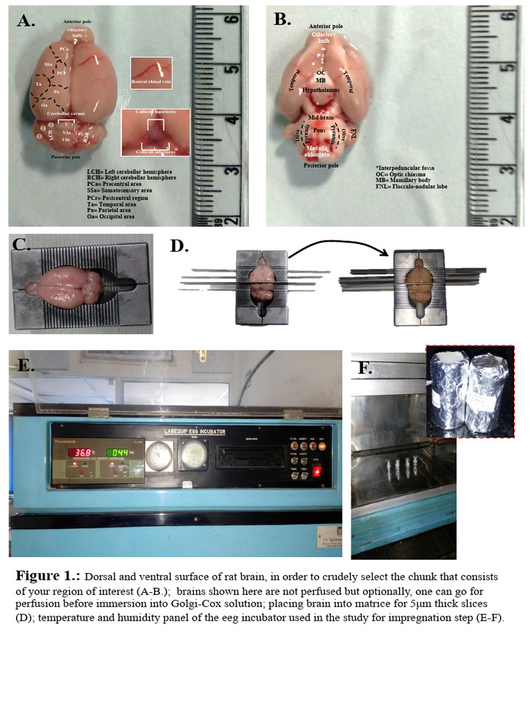 Rat Brain Imaging and Tracing Techniques | PDF | Hippocampus ...