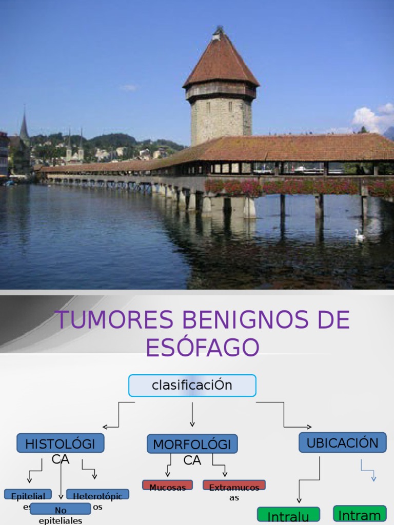 Tumores Benignos de Esófago | PDF | Cáncer de esófago | Metástasis