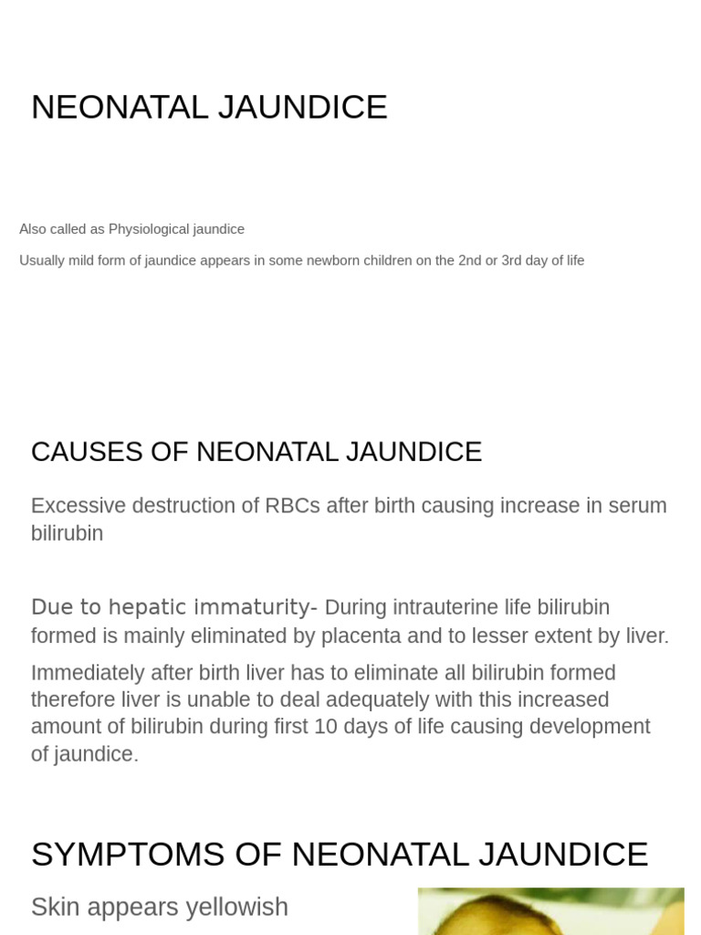 Neonatal Jaundice New | PDF