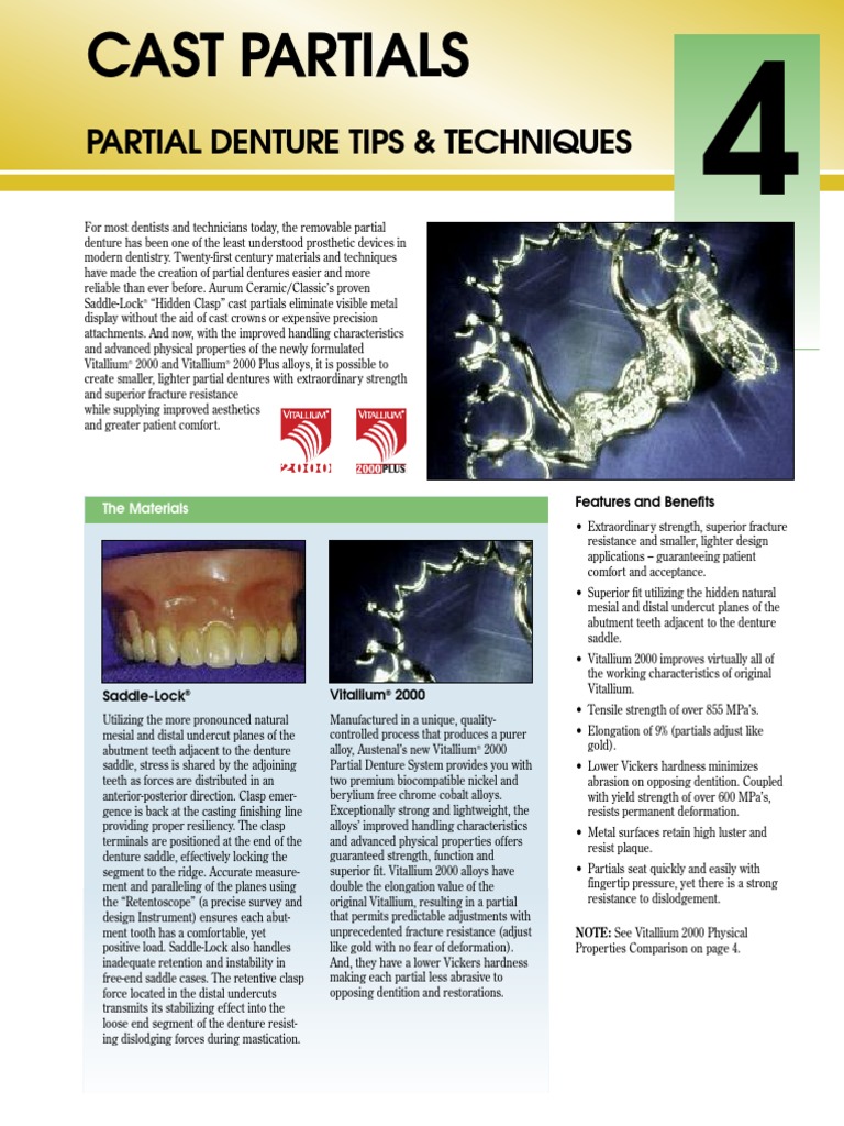 Cast Partials: Partial Denture Tips & Techniques | PDF | Dentures ...