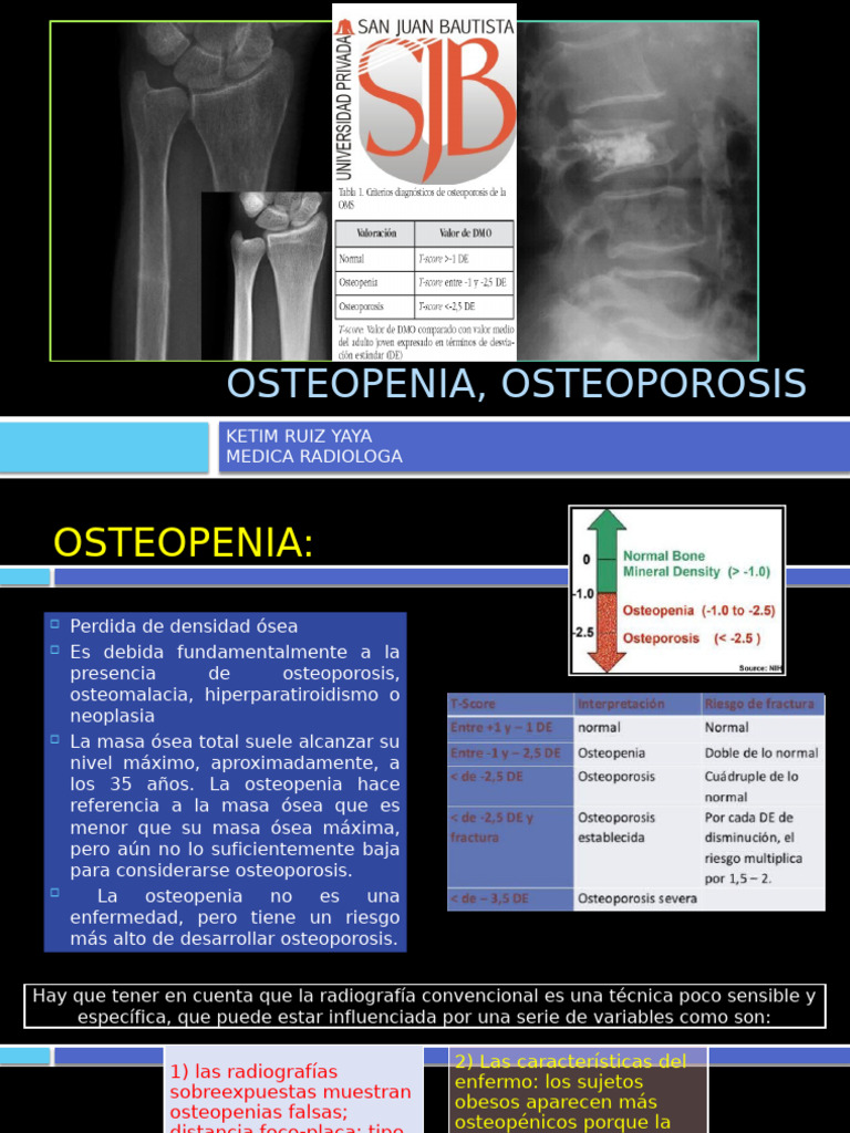 Osteopenia y osteoporosis: diagnóstico y riesgos | PDF | Osteoporosis ...