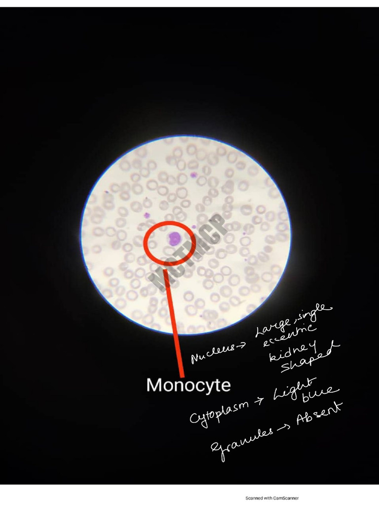Peripheral Blood Smear Slide Notes | PDF
