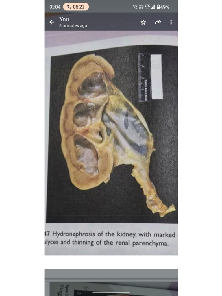 Pathology Gross Specimen Pdf