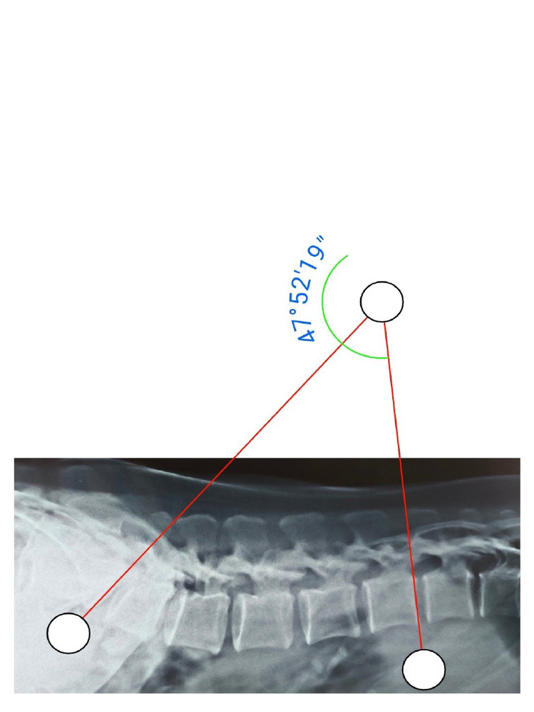 Xray of Ls Spine Lunber | PDF