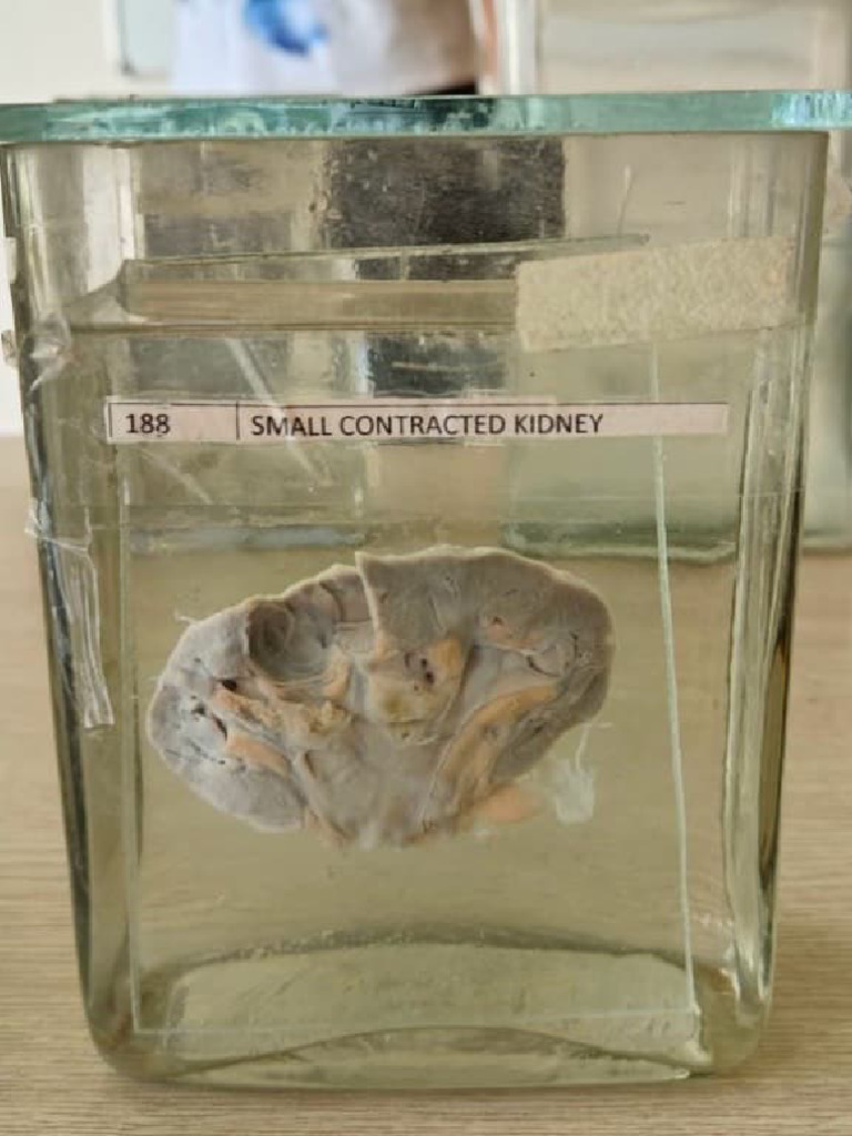 Specimen Pathology | PDF