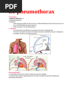Traitement chirurgical du pneumothorax | PDF | Thorax | Médecine clinique