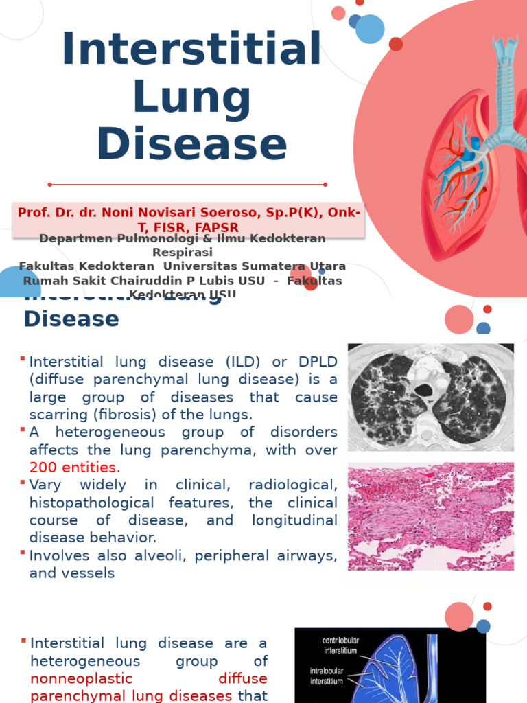 Overview of Interstitial Lung Disease | PDF | Pneumonia | Lung
