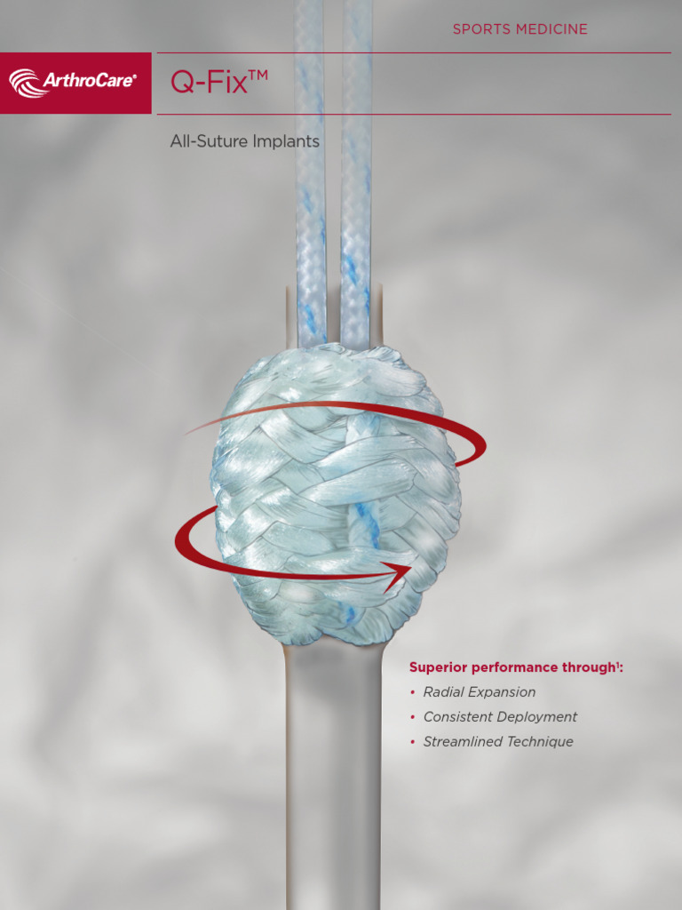 Q-Fix All-Suture Implant Overview | PDF | Dental Implant | Implant ...
